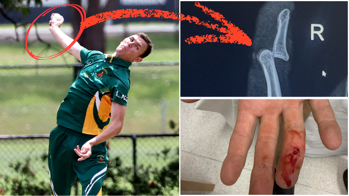 Gruesome cricket injury