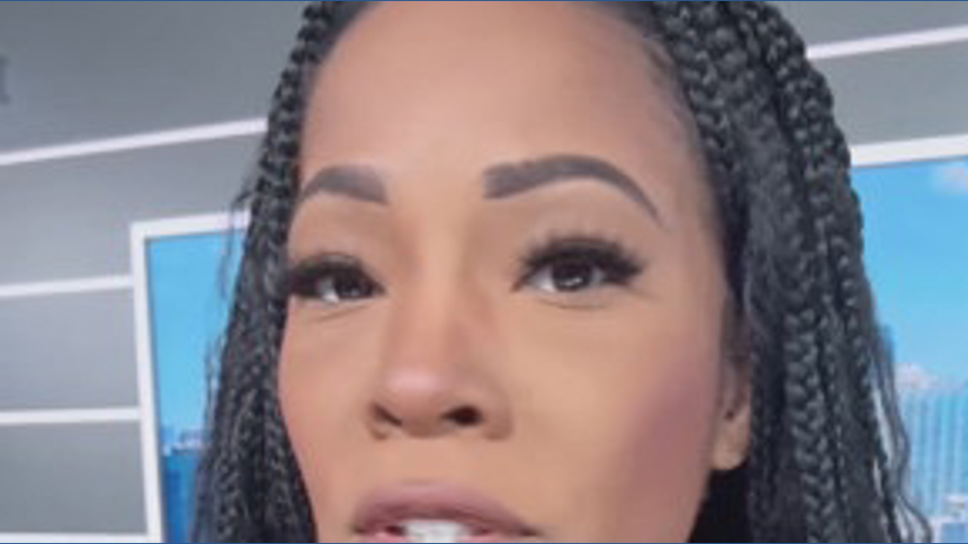 Woman suffers severe chemical burns in acid attack in Savannah