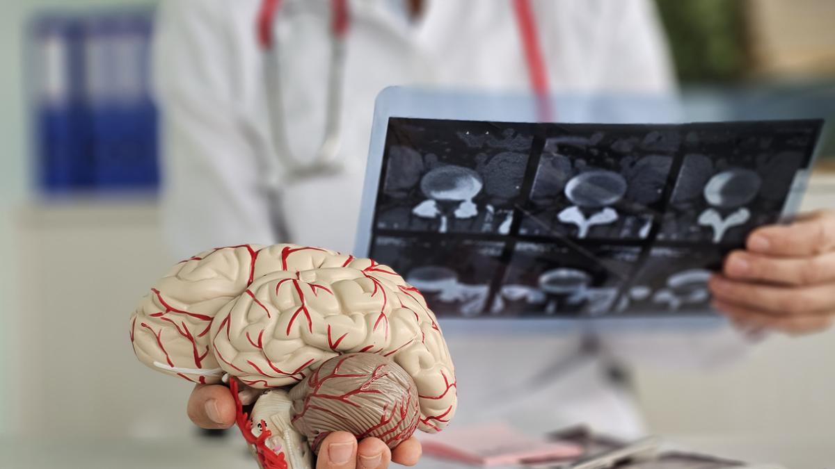 Descubren cómo el virus del beso podría abrir la puerta a la esclerosis ...