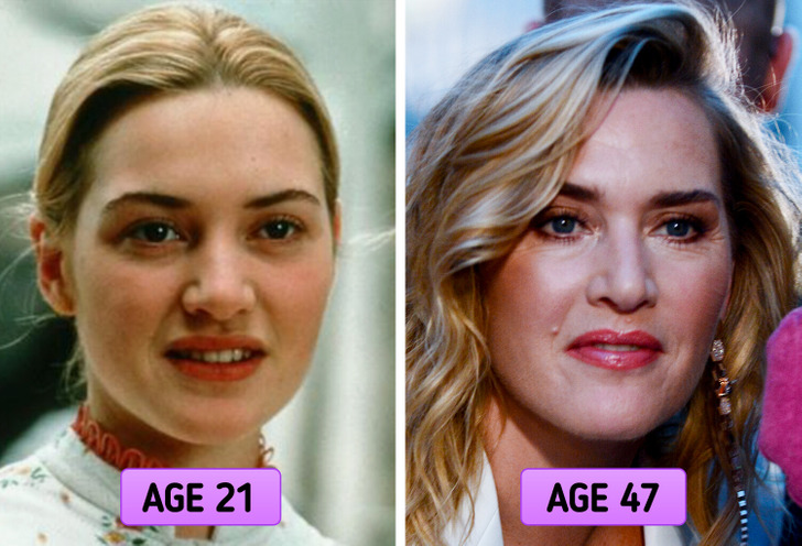 15 celebrities who embrace aging gracefully — no fillers required