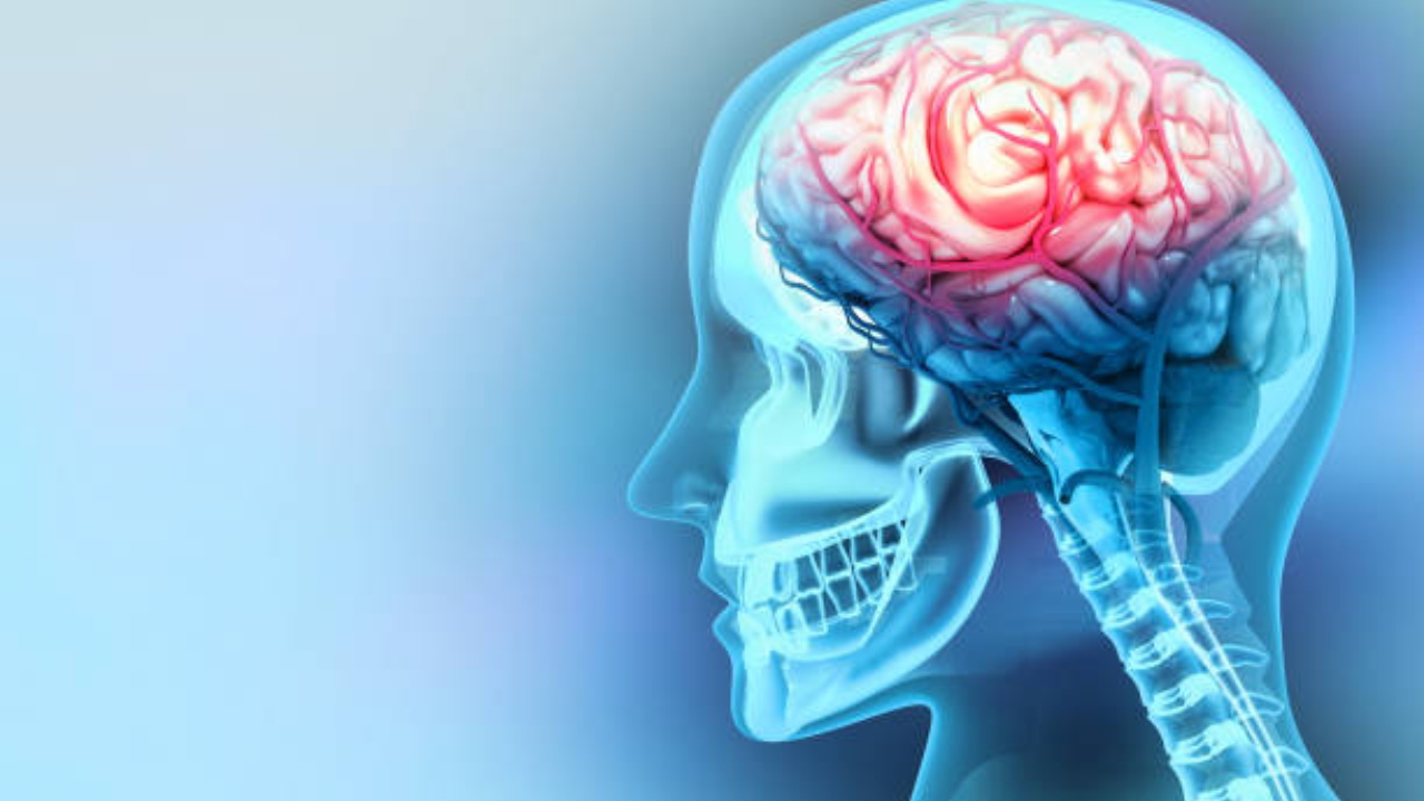 Aneurysm: Why some brain blood vessels weaken without warning