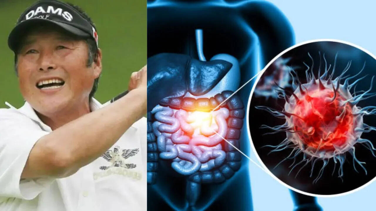 Masashi Ozaki death: What is sigmoid colon cancer and why is it always ...