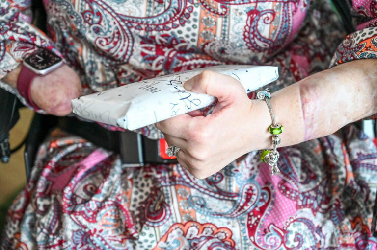 Quadruple amputee can open Christmas presents for first time in years ...