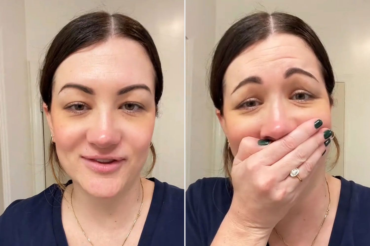 'Veteran' Botox user is shocked by latest injection results: 'My fiancé ...