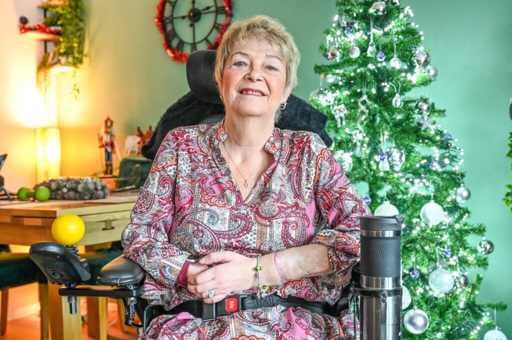 Quadruple amputee can open Christmas presents for first time in years ...