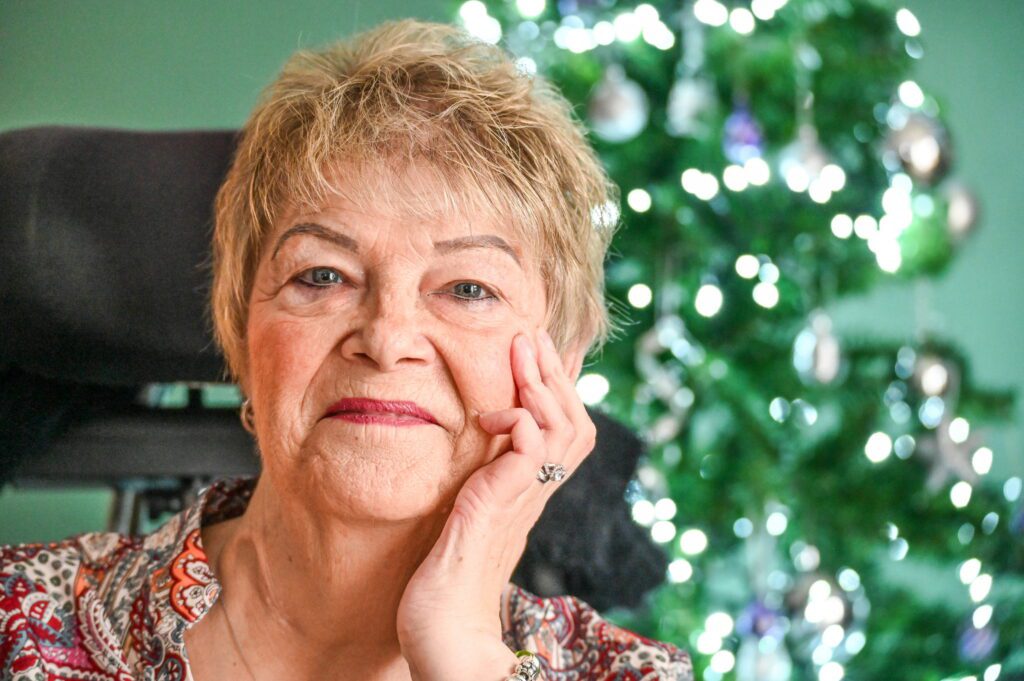 Quadruple amputee can open Christmas presents for first time in years ...