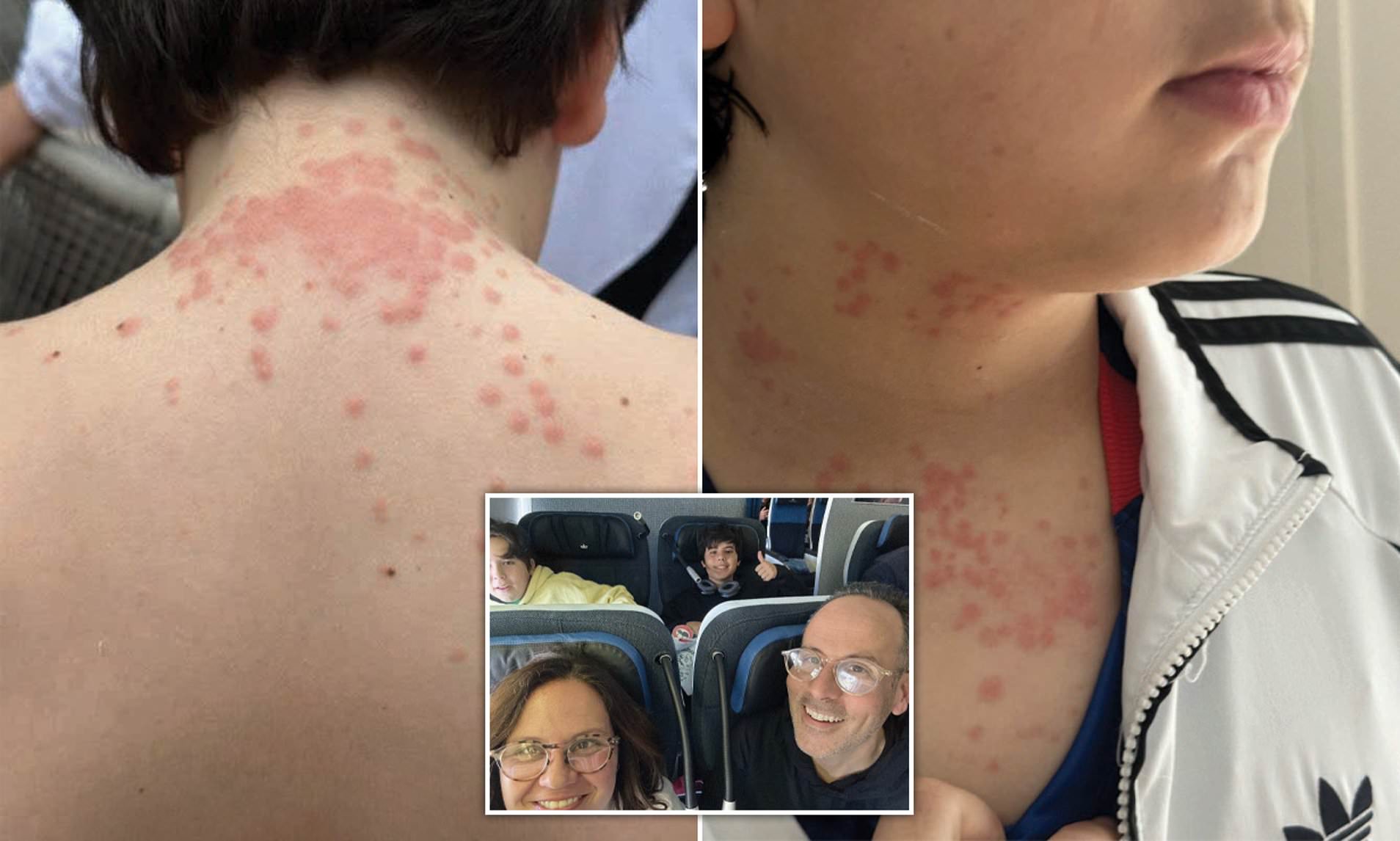 Family sues Delta after being 'swarmed and bitten by bedbugs' on flight ...