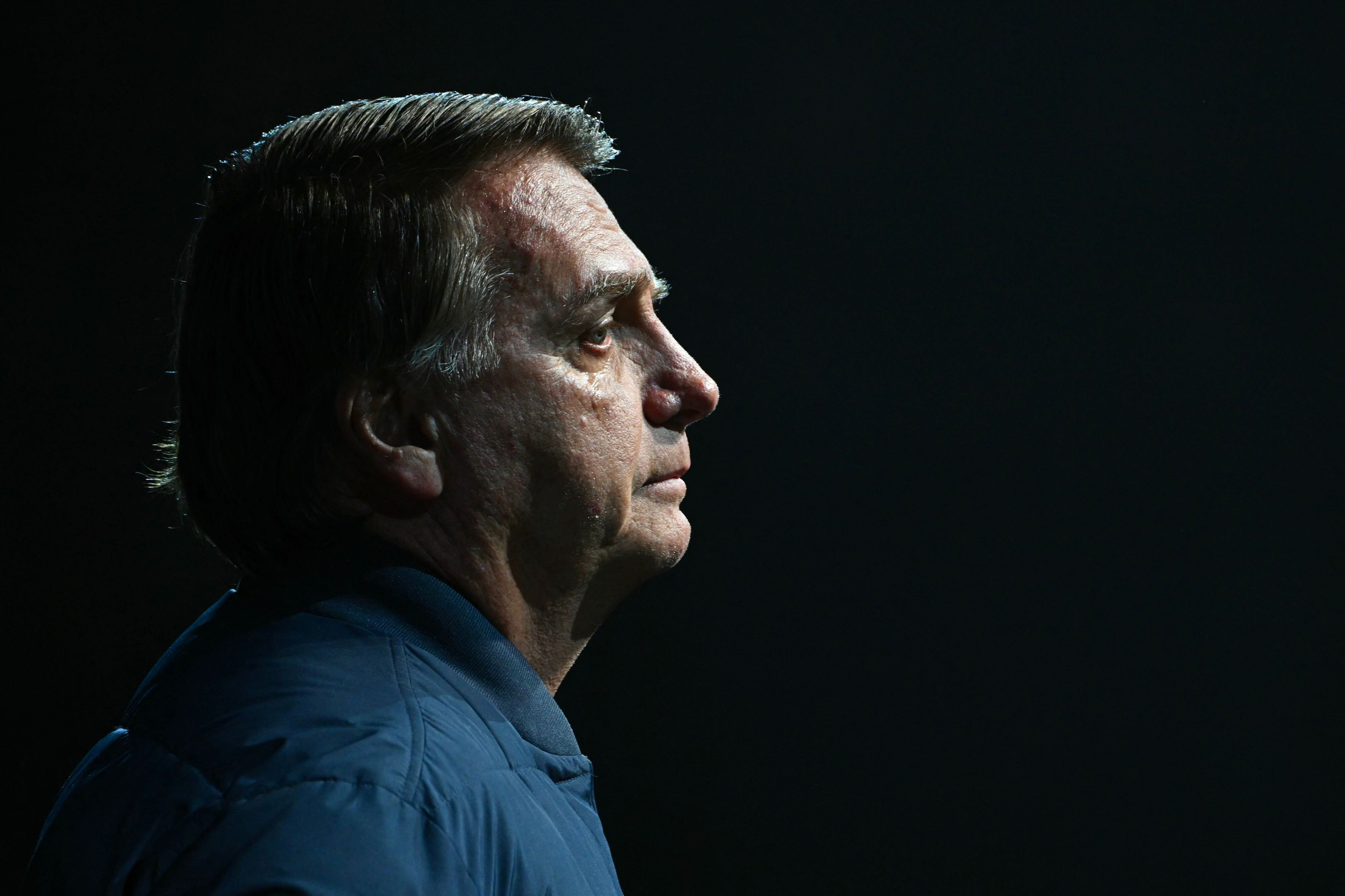 Kupdømt Bolsonaro er blevet opereret for lyskebrok