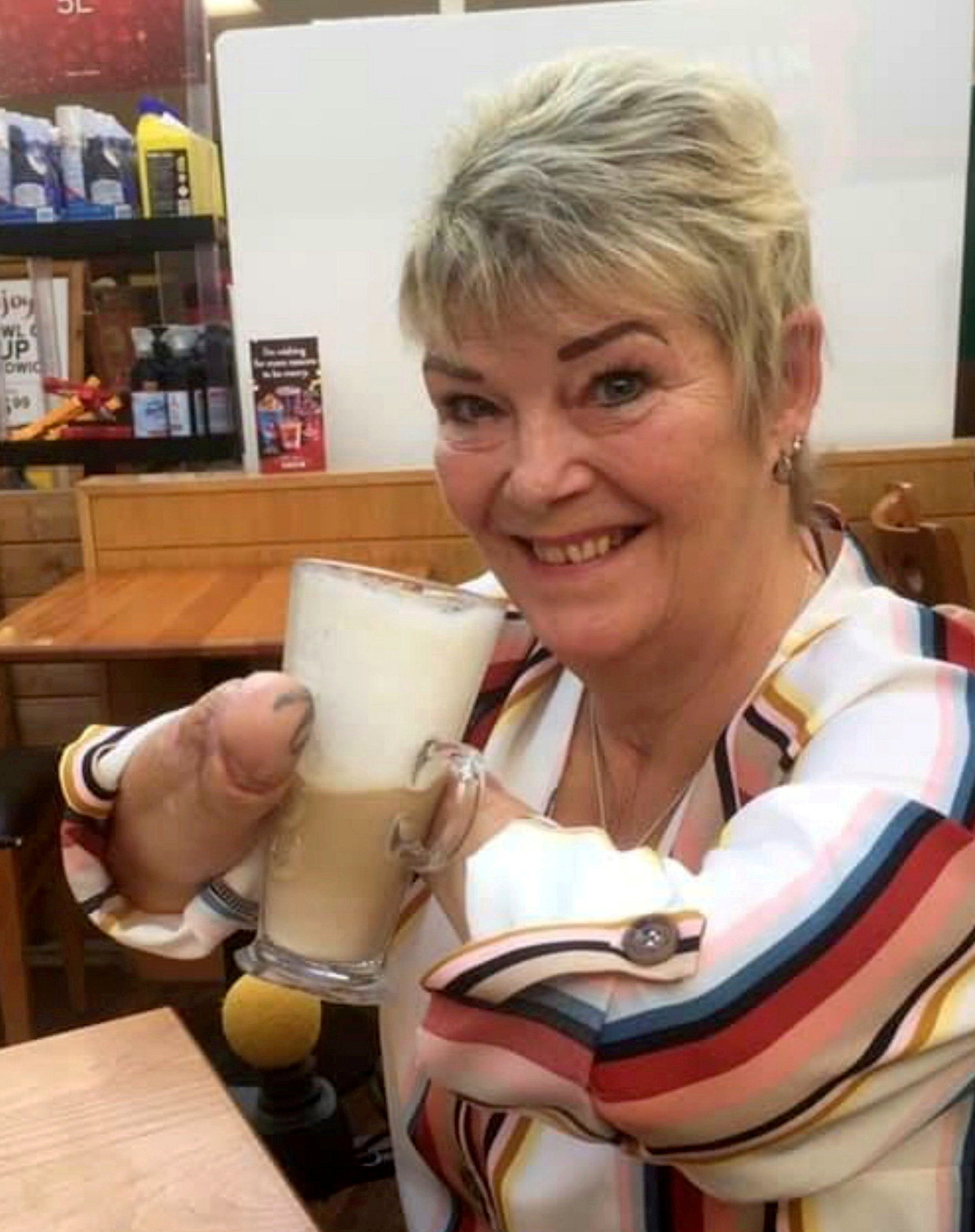'I was right-handed but now I am left-handed' quadruple amputee reveals ...