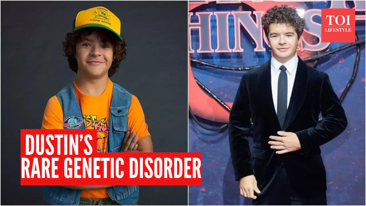Stranger Things' Dustin Henderson's toothless smile is due to a rare ...