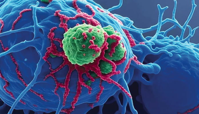 Disrupted sleep cycles linked to aggressive breast cancer: Study