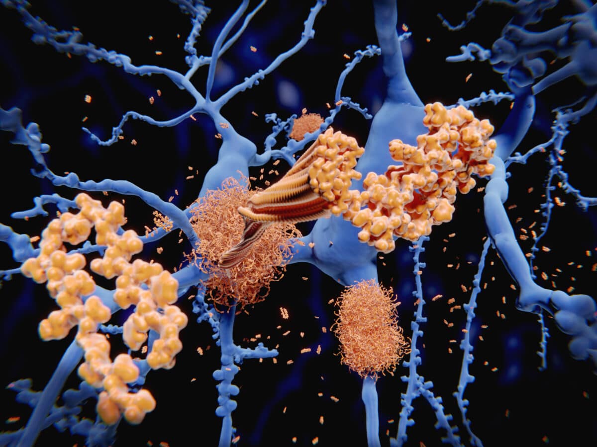 Major Alzheimer’s breakthrough? Advanced-stage mice fully recover after ...