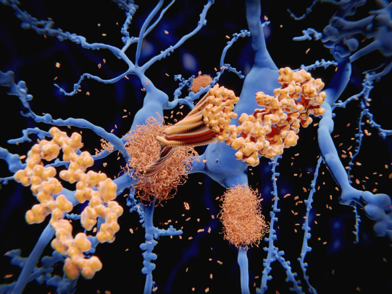 Major Alzheimer’s breakthrough? Advanced-stage mice fully recover after ...