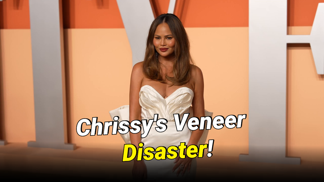 Holidays gone wrong: Chrissy Teigen knocks out her front tooth during ...