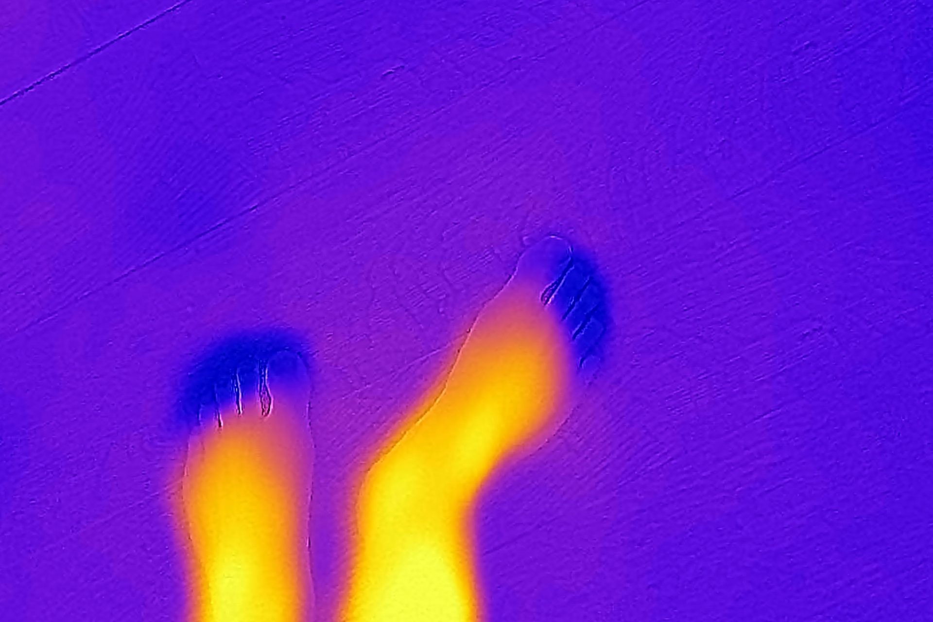 What your feet can tell you about your overall health