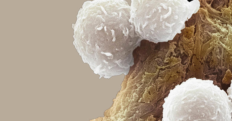 Universal Vaccine To Treat All Cancers Is Now Enterring Human Trials