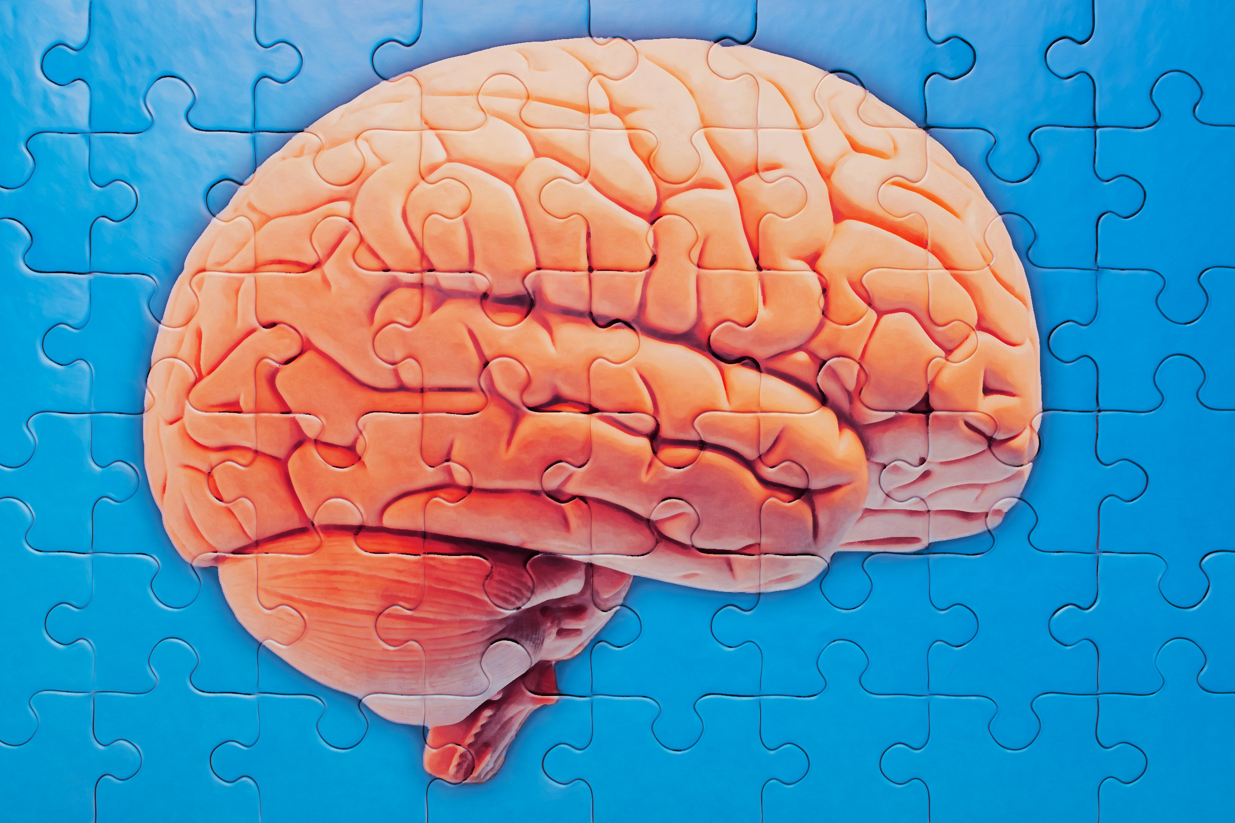 Scientists identify possible game changing treatment for Alzheimer’s ...