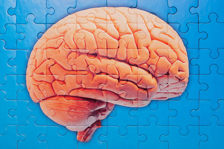 Scientists identify possible game changing treatment for Alzheimer’s ...