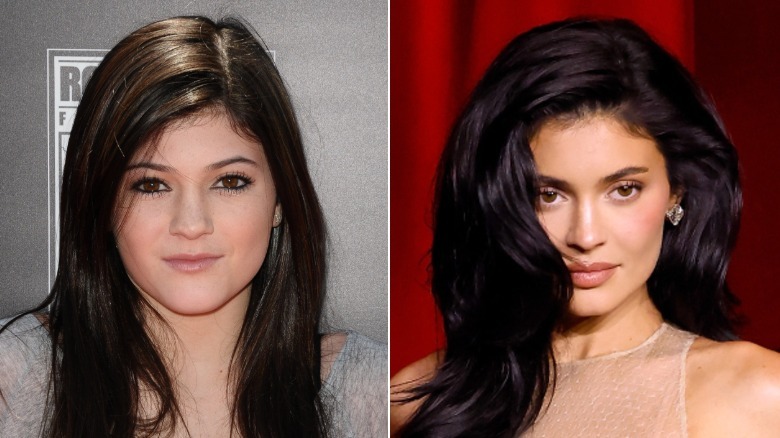 Side-by-side pics of Kylie Jenner's face transformation are jarring