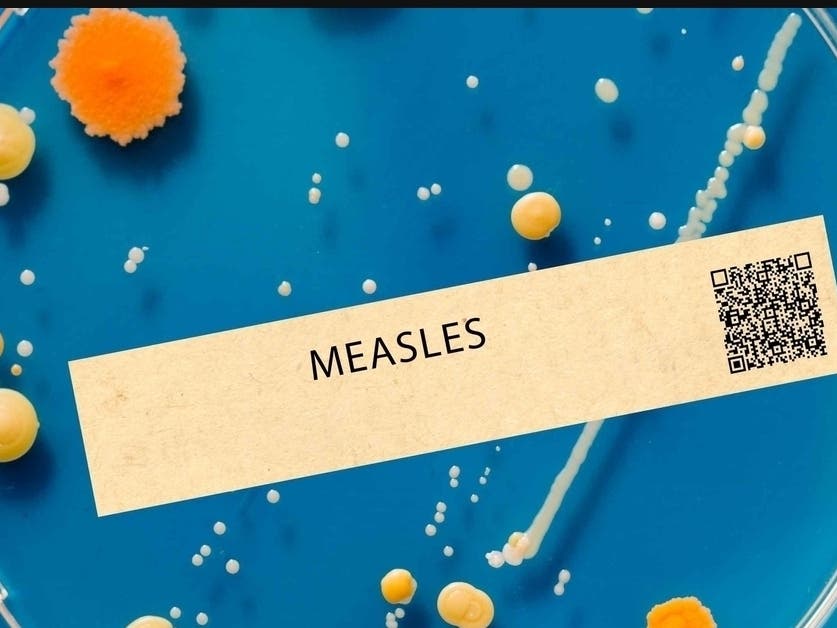 Possible measles exposure at Newark Airport amid holiday travel: Health ...