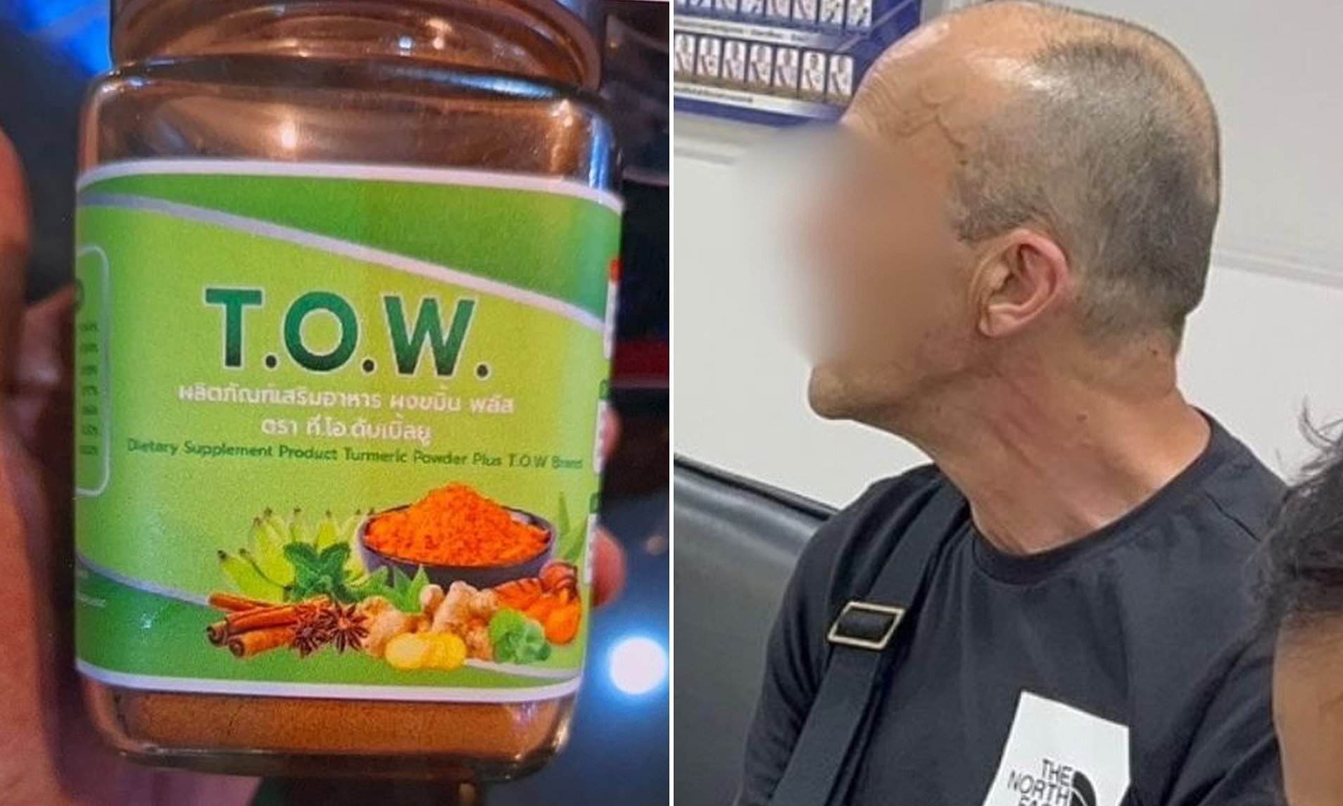 Balding German man reports hair growth scam to Thai police after being ...