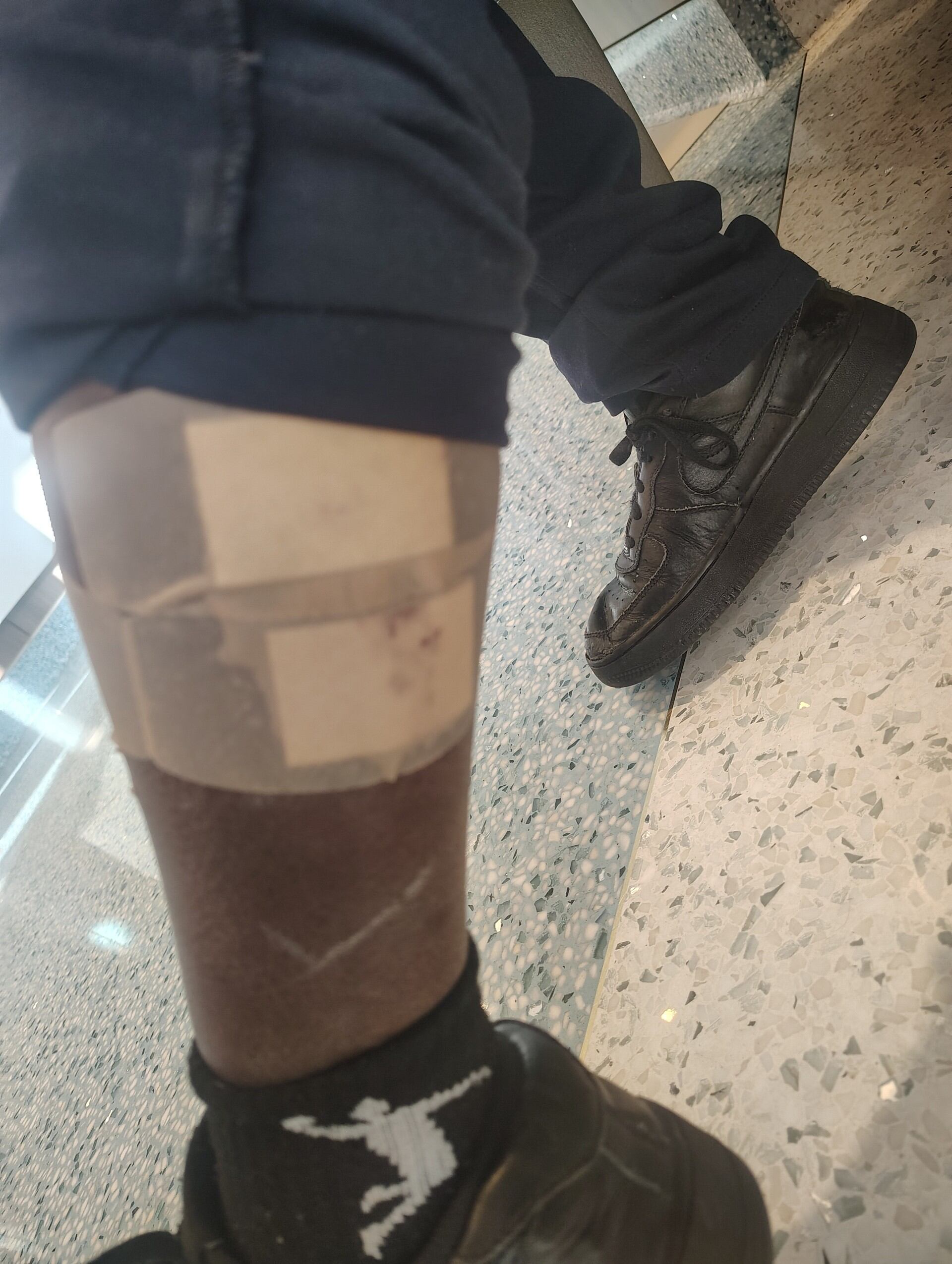 Eight Mile mother recounts dog attack on 9-year-old son after school ...