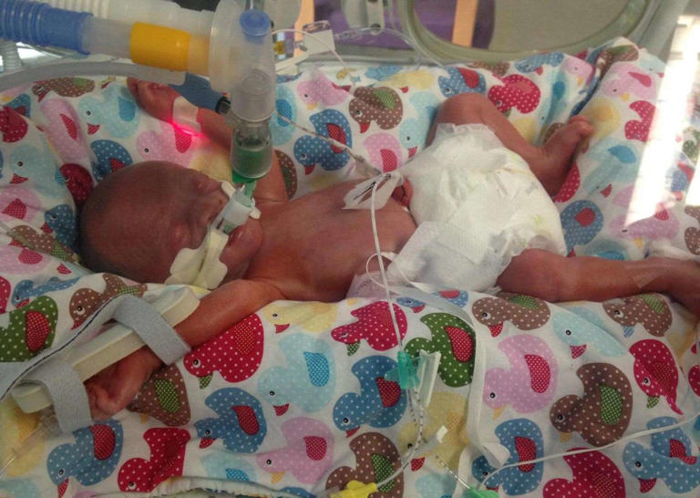 Sittingbourne boy with cerebral palsy takes first independent steps as ...