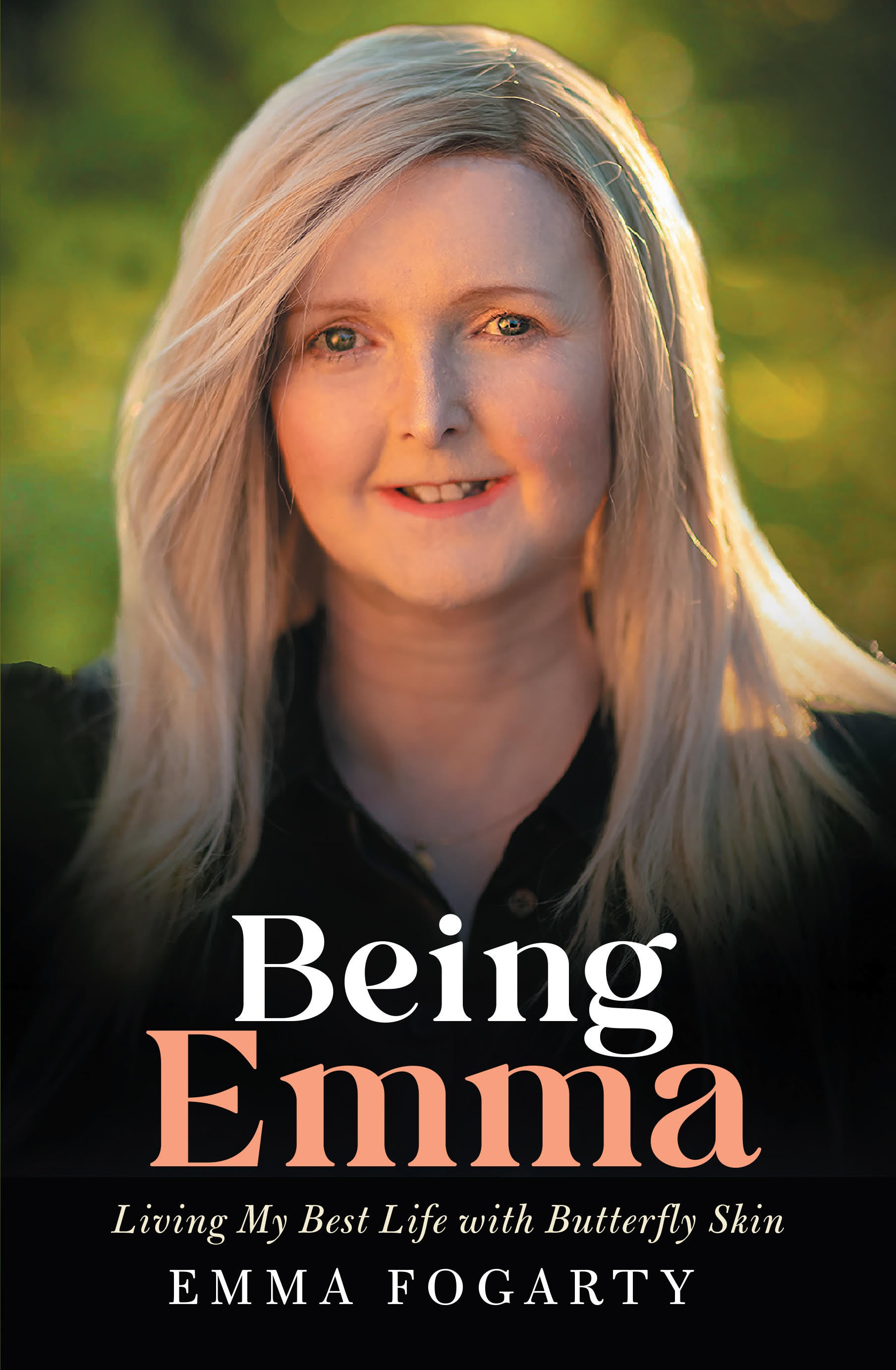 Emma Fogarty talks friendship with Colin Farrell, her genetic disorder