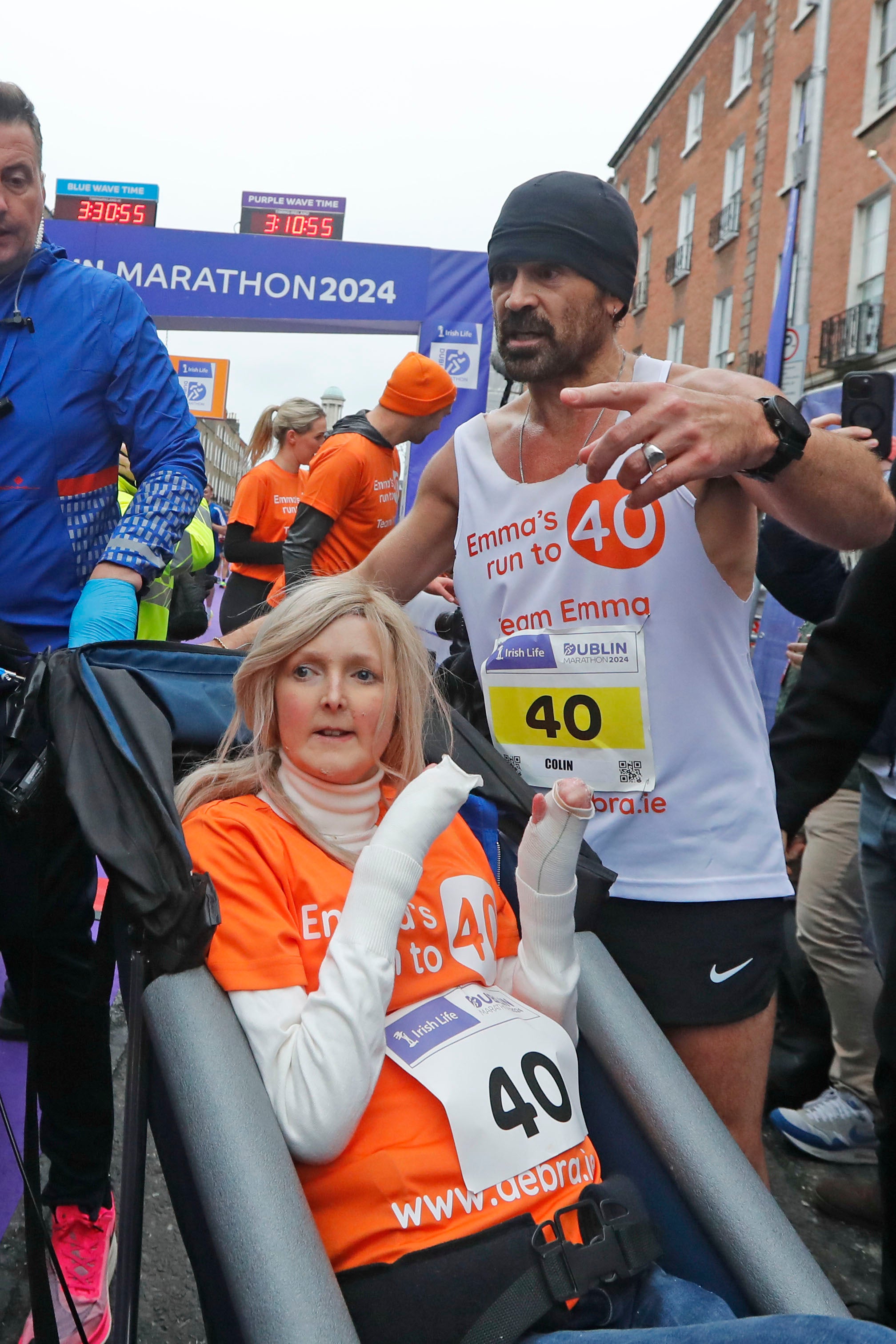 Emma Fogarty talks friendship with Colin Farrell, her genetic disorder