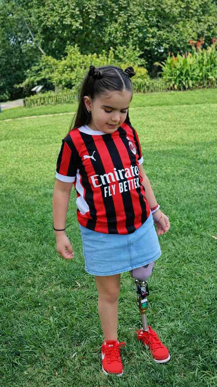 She lost her leg to cancer but not her smile