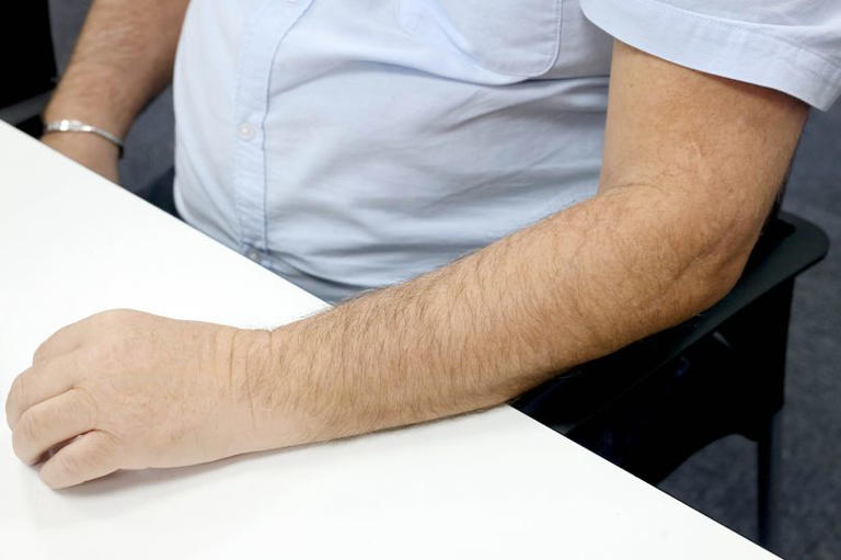 I sued Amazon over an injury then men started following me