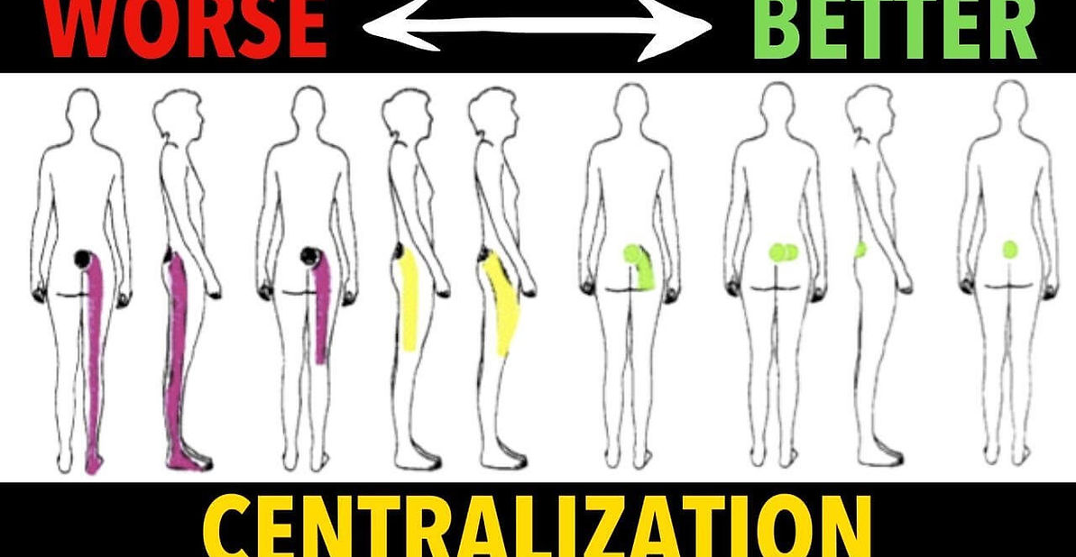 Directionally specific exercises for low back pain