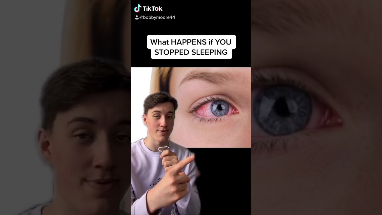 What long-term sleep deprivation can do to the human body