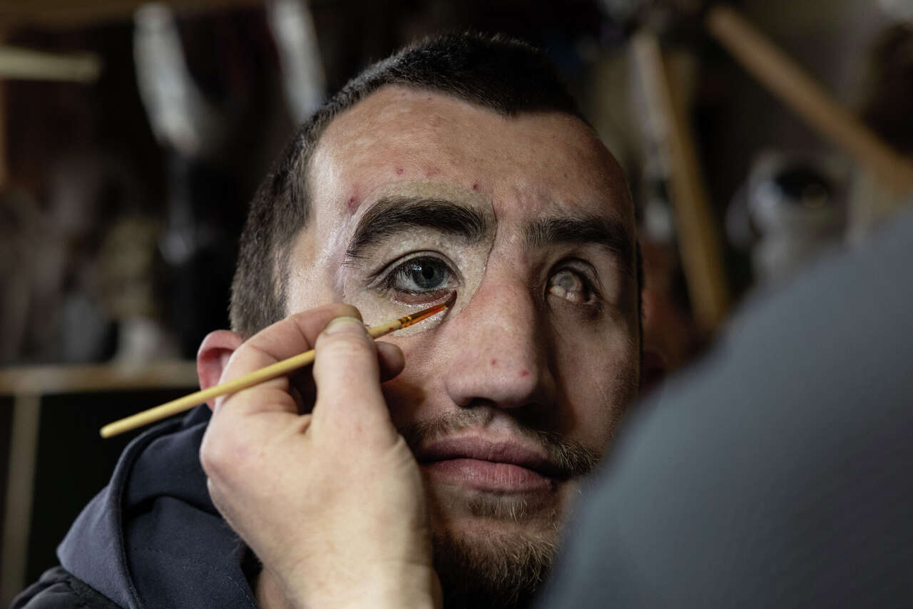 The wounds of war: Injured Ukraine soldiers heal bodies and spirits