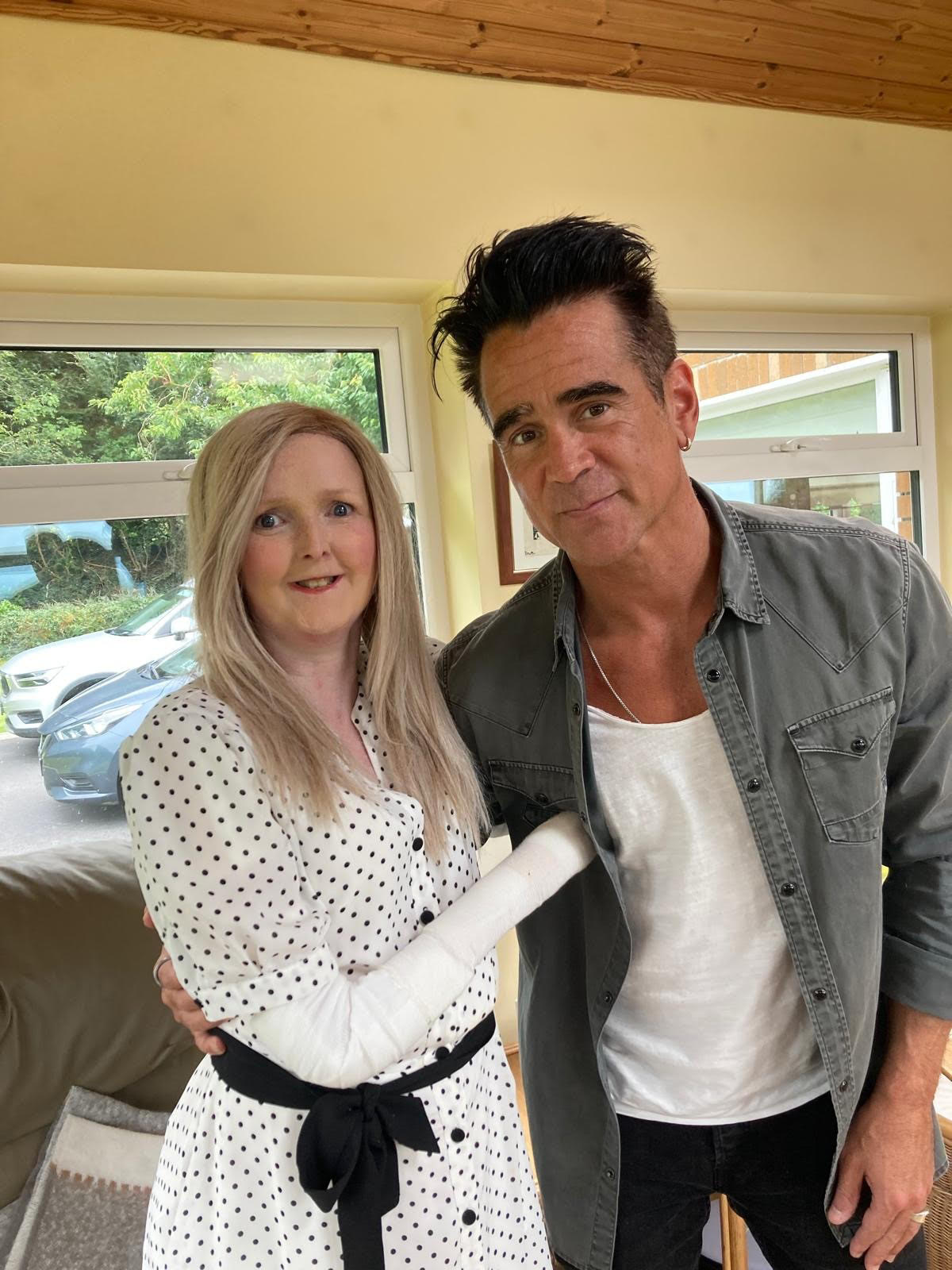 Emma Fogarty talks friendship with Colin Farrell, her genetic disorder