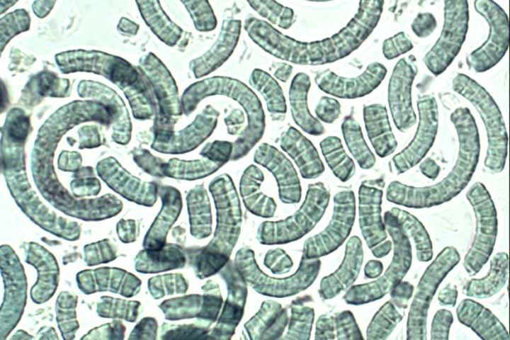 Conhece esta alga poderosa? Spirulina se destaca no combate à anemia