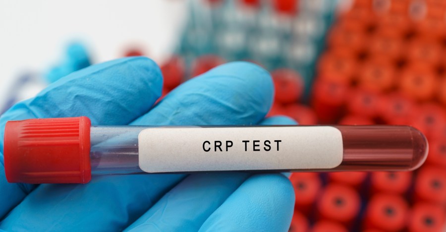 C-reactive protein outranks 'bad' cholesterol as leading heart disease ...