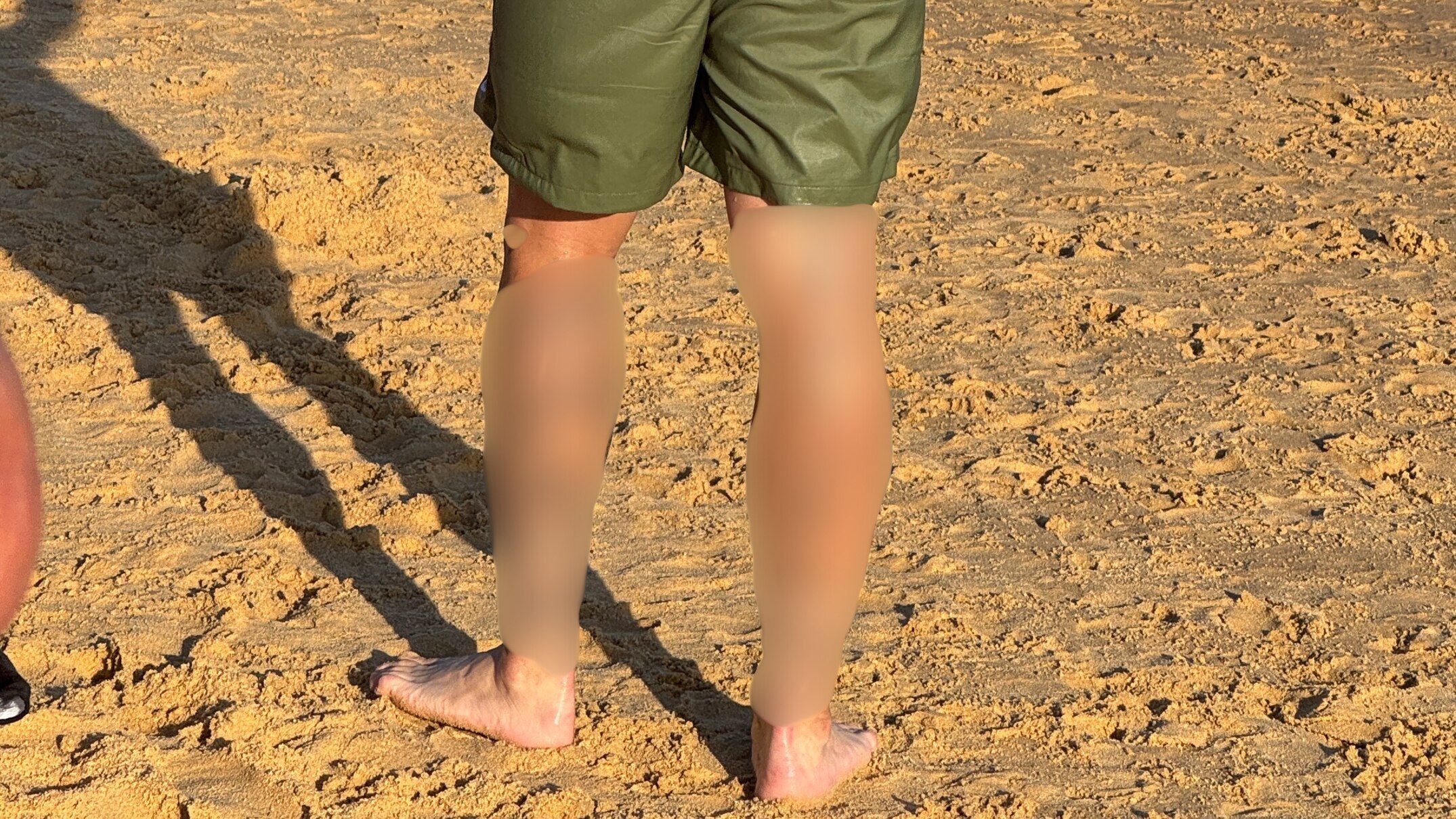 Man charged for allegedly displaying hate symbol tattoos at Newcastle beach