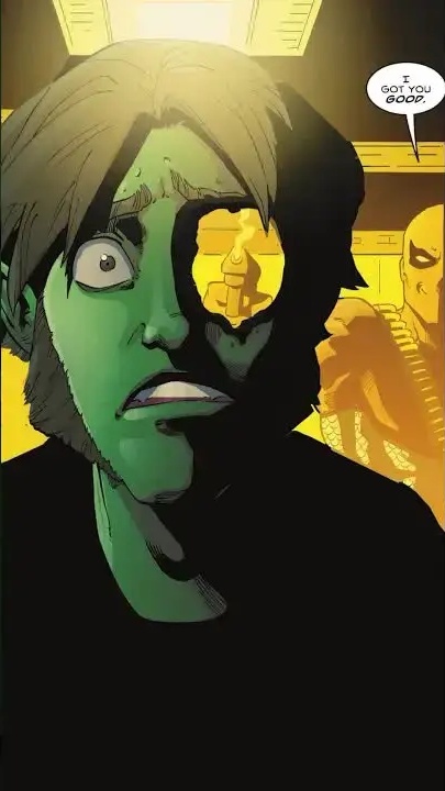 How did Beast Boy get his eye back? #dccomics #shorts