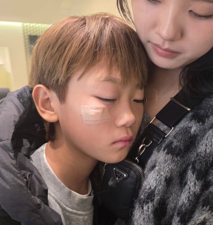 이동국 막내 시안, 얼굴 깊은 상처에 6바늘…흉터날까 걱정