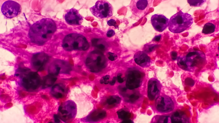 Cells may remain alive in a mysterious state between life and death