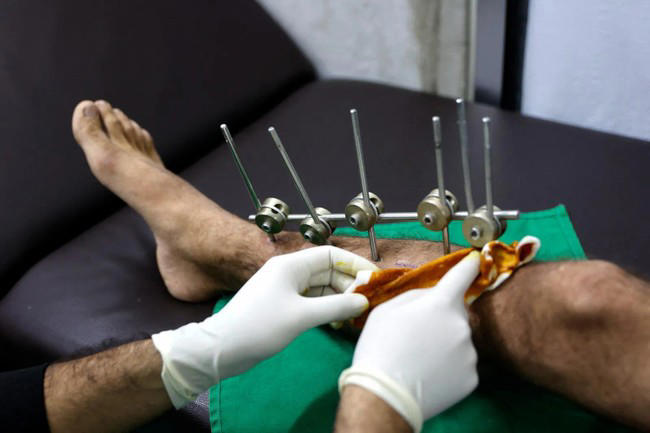 Bleak future awaits aid agencies amid Israel ban