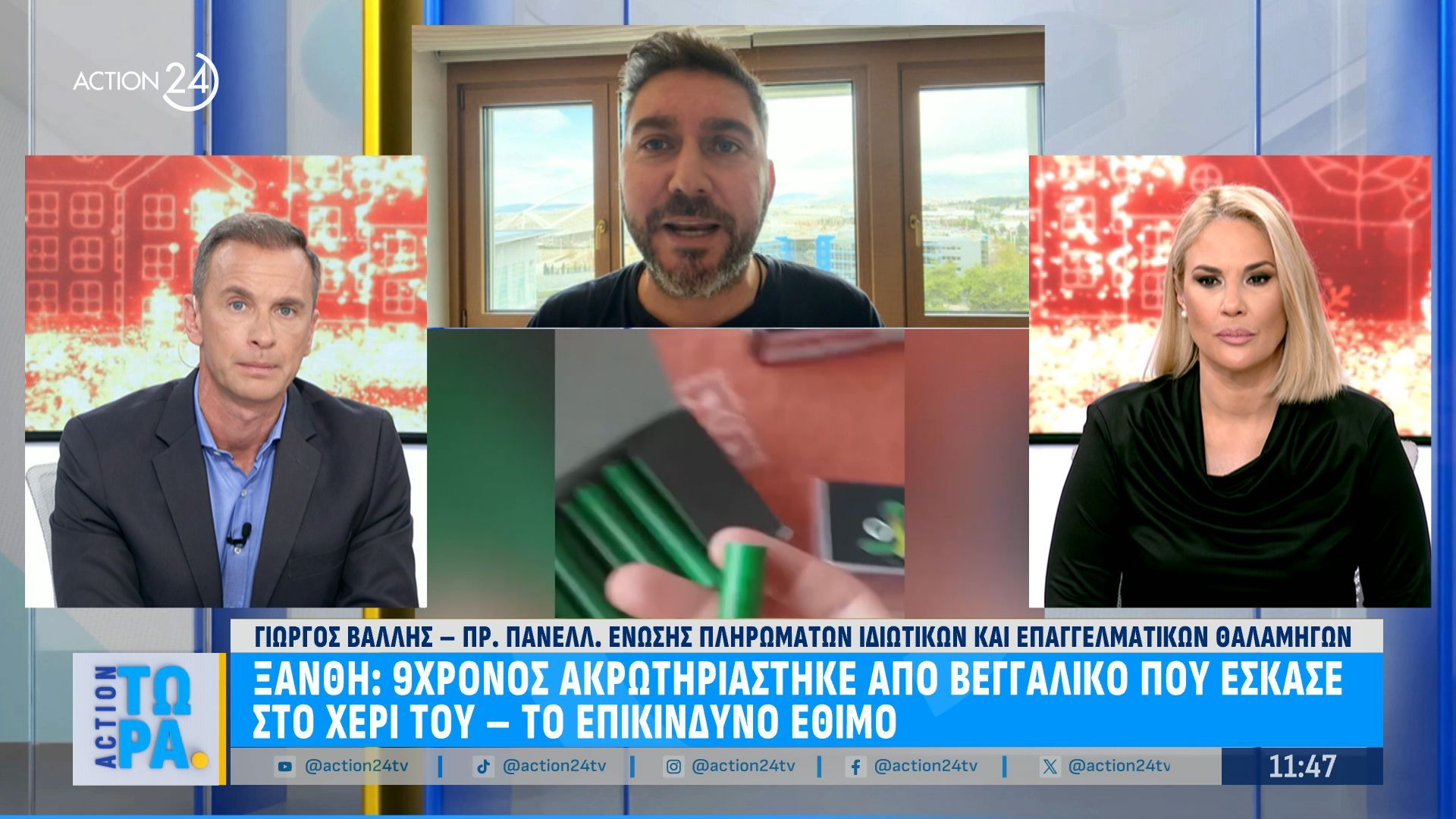 Ξάνθη: 9χρονος ακρωτηριάστηκε από βεγγαλικό που έσκασε στο χέρι του ...