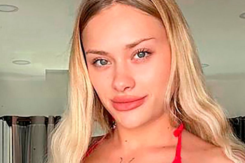 OnlyFans model 'scalped and thrown from roof' learns to walk again