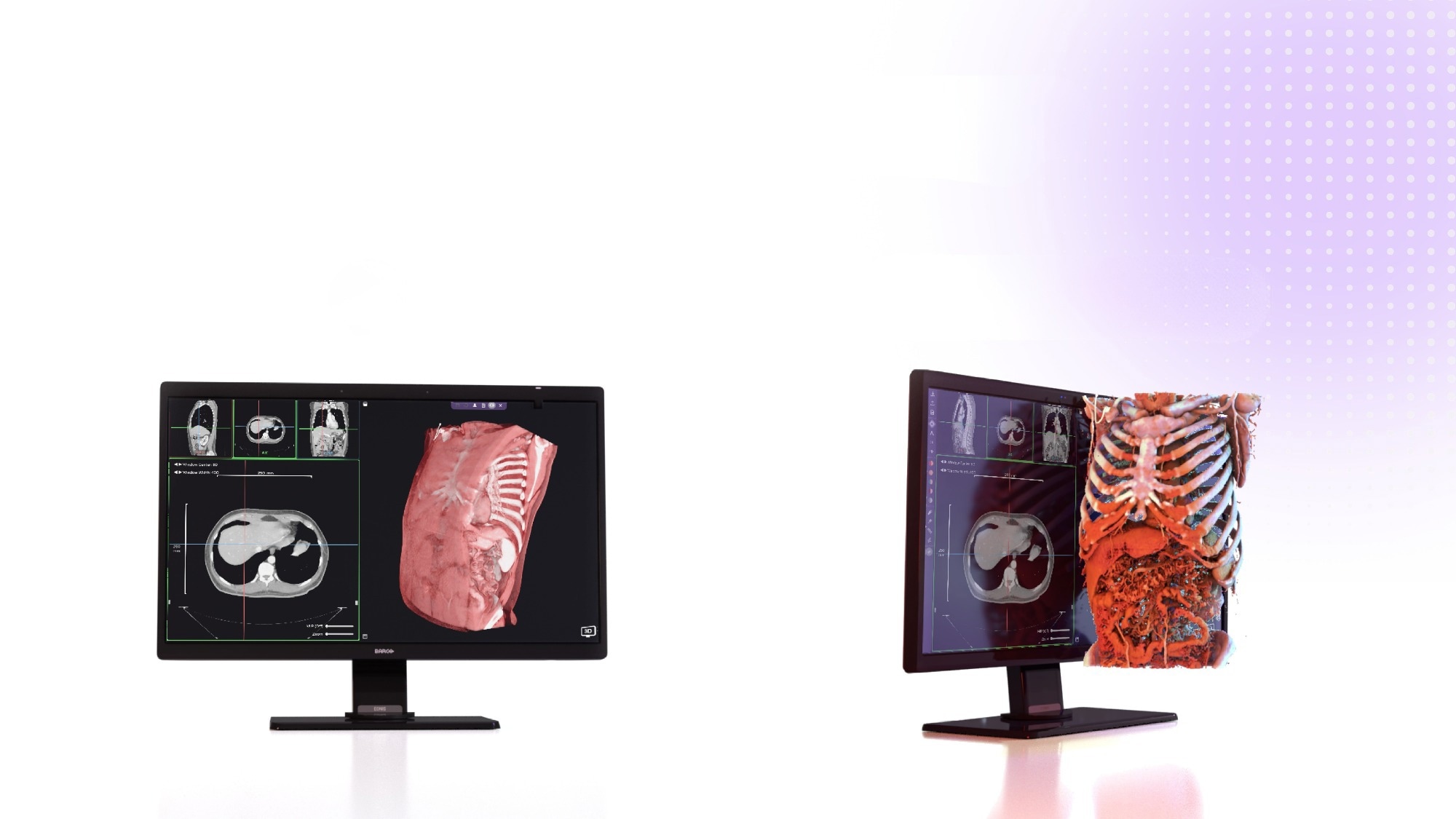 How Avatar Medical's 3D technology is transforming how we visualize the ...