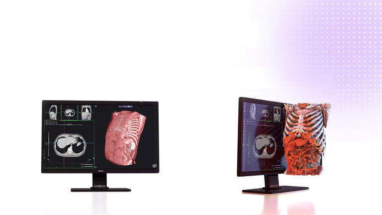 How Avatar Medical's 3D technology is transforming how we visualize the ...