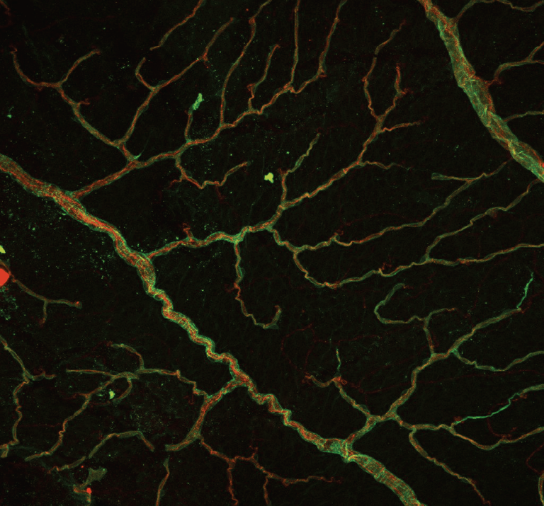 Your eye doctor may be able to spot dementia flags before memory ...