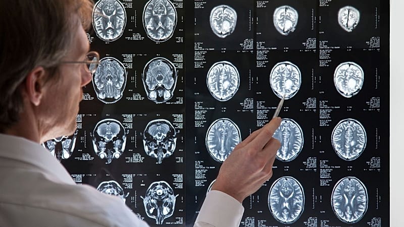 Why do some brains adapt to change faster than others? New study offers ...