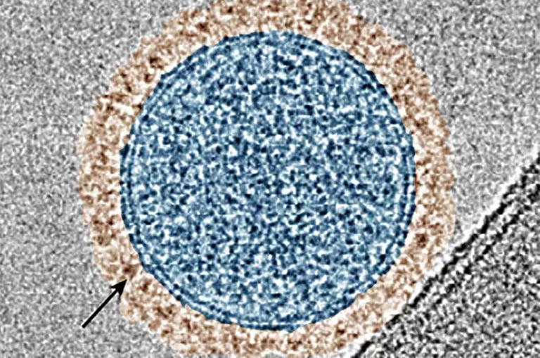 Inhalable nanotherapy against advanced melanoma aims for one-two punch