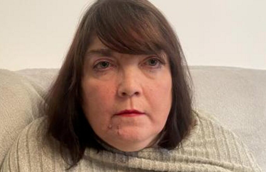 Disabled mum unable to walk left fuming after being told by DWP to 'get ...